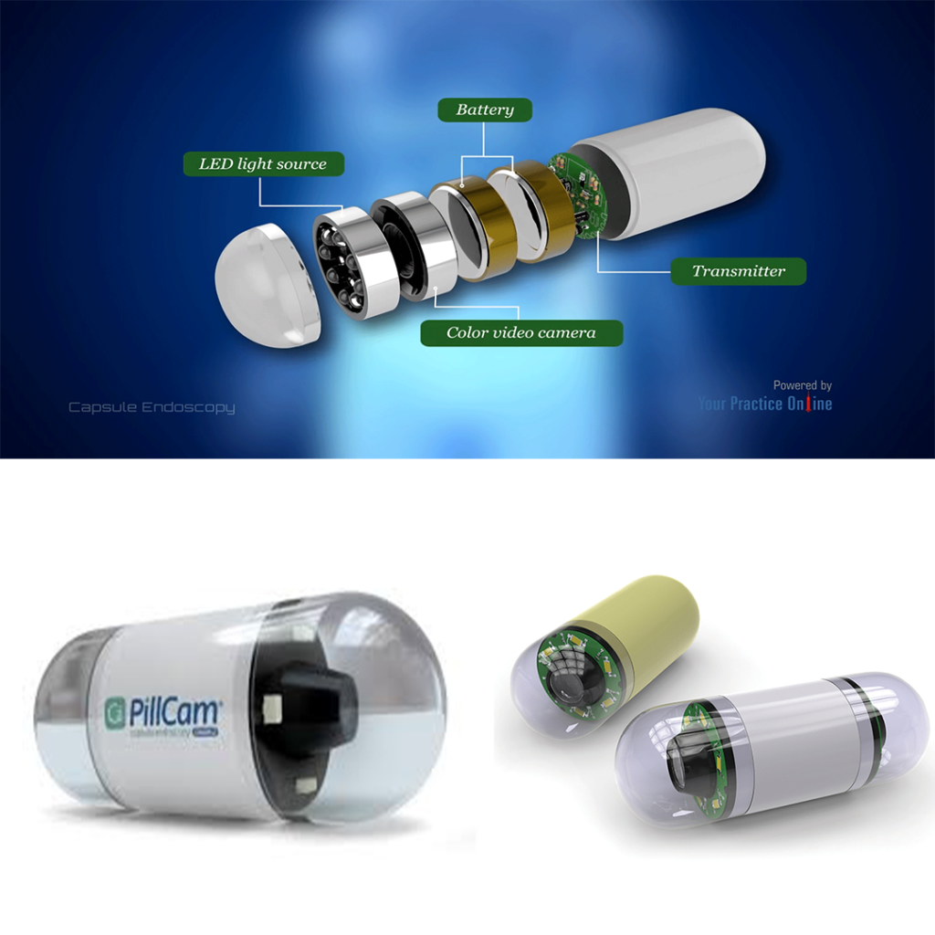 Capsule Endoscopy - Aayushman Clinic